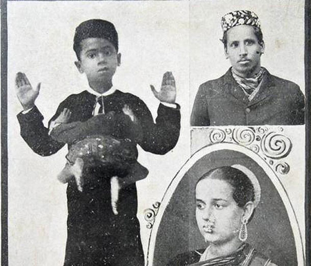 21 Rare Old Photographs Of Real American Freak Shows - Atchuup! - Cool ...