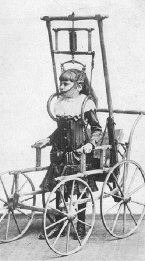 28 Rare Medical Photos In History That Show How Doctors Treated Their ...