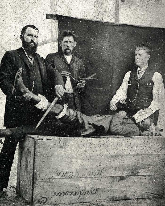 28 Rare Medical Photos In History That Show How Doctors Treated Their ...